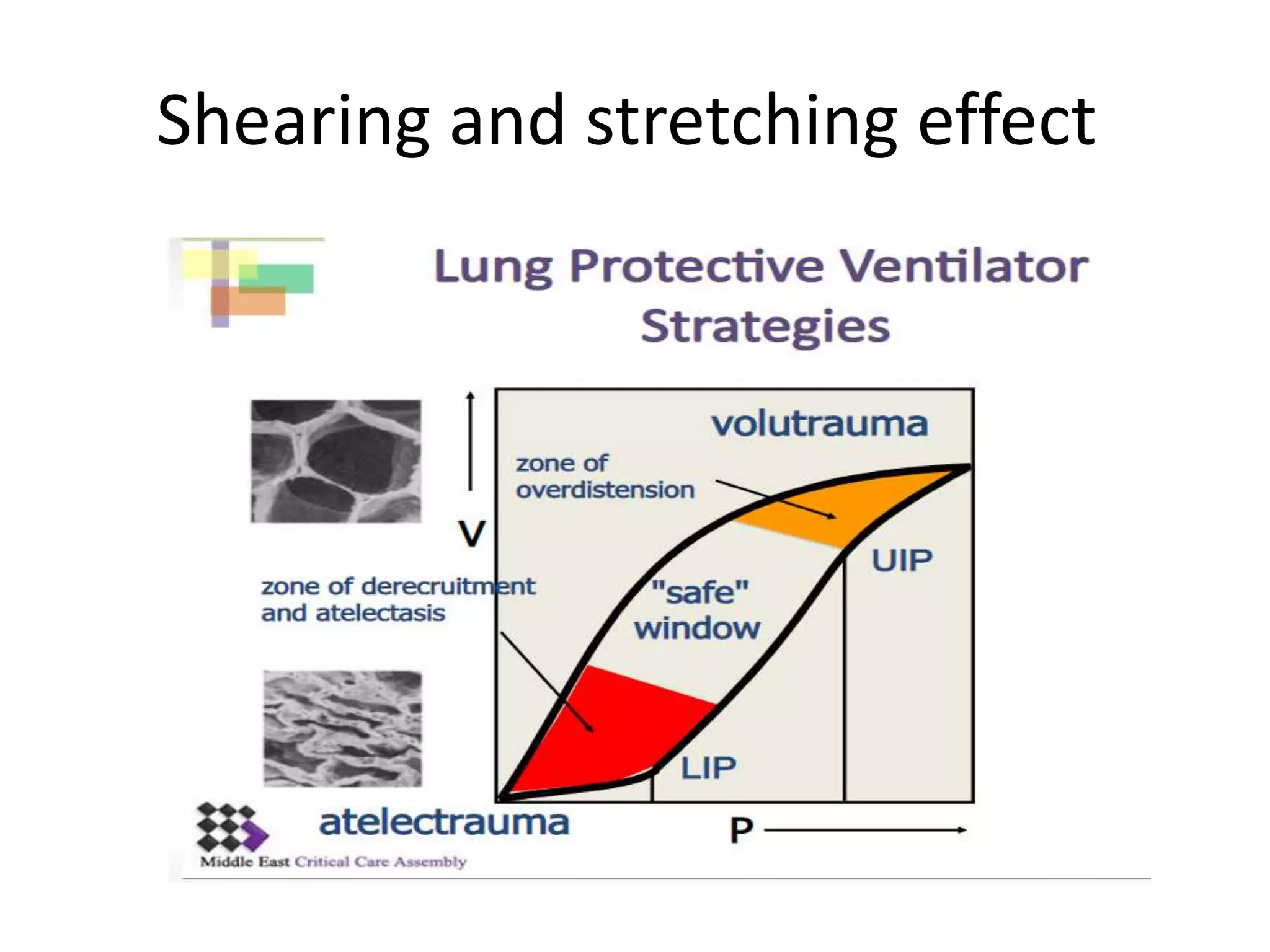 Part 7 Diseases Specific Ventilation Strategy Pptx