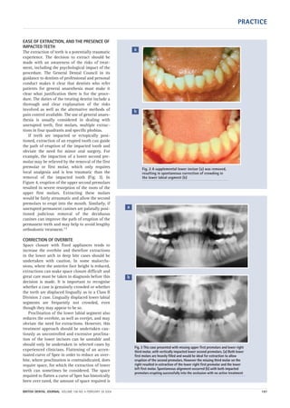 Part 8 extraction in orthodontics | PDF
