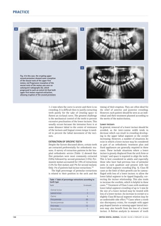 Part 8 extraction in orthodontics | PDF