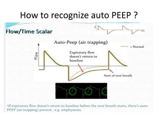 Part 8 mechanical ventilation | PPT