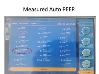 Part 8 mechanical ventilation | PPT
