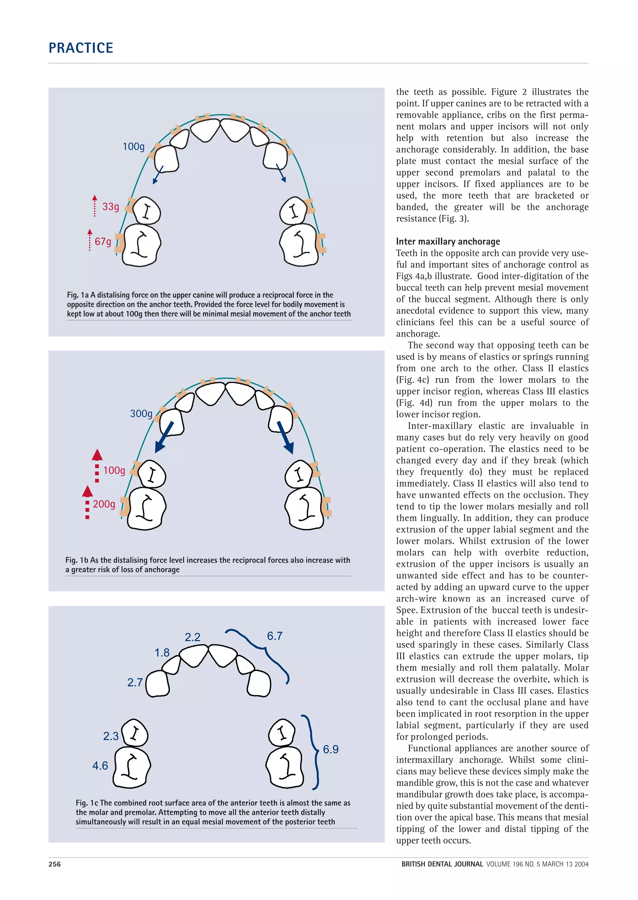 Part 9 anchorage control and distal movement | PDF