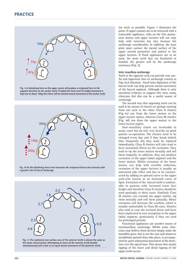 Part 9 anchorage control and distal movement | PDF