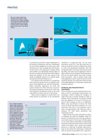 Part 9 anchorage control and distal movement | PDF