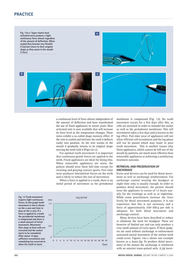 Part 9 anchorage control and distal movement | PDF