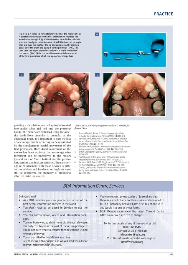 Part 9 anchorage control and distal movement | PDF