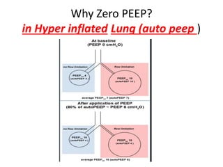 Part 9 mechanical ventilation | PPT