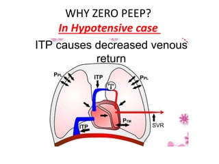 Part 9 mechanical ventilation | PPT