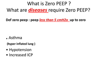 Part 9 mechanical ventilation | PPTX