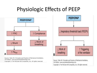 Part 9 mechanical ventilation | PPTX