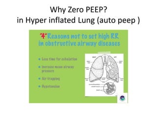 Part 9 mechanical ventilation | PPT