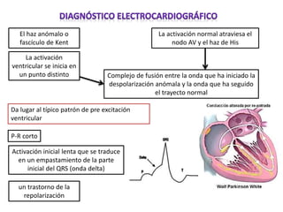 Arritmias supraventriculares | PPTX