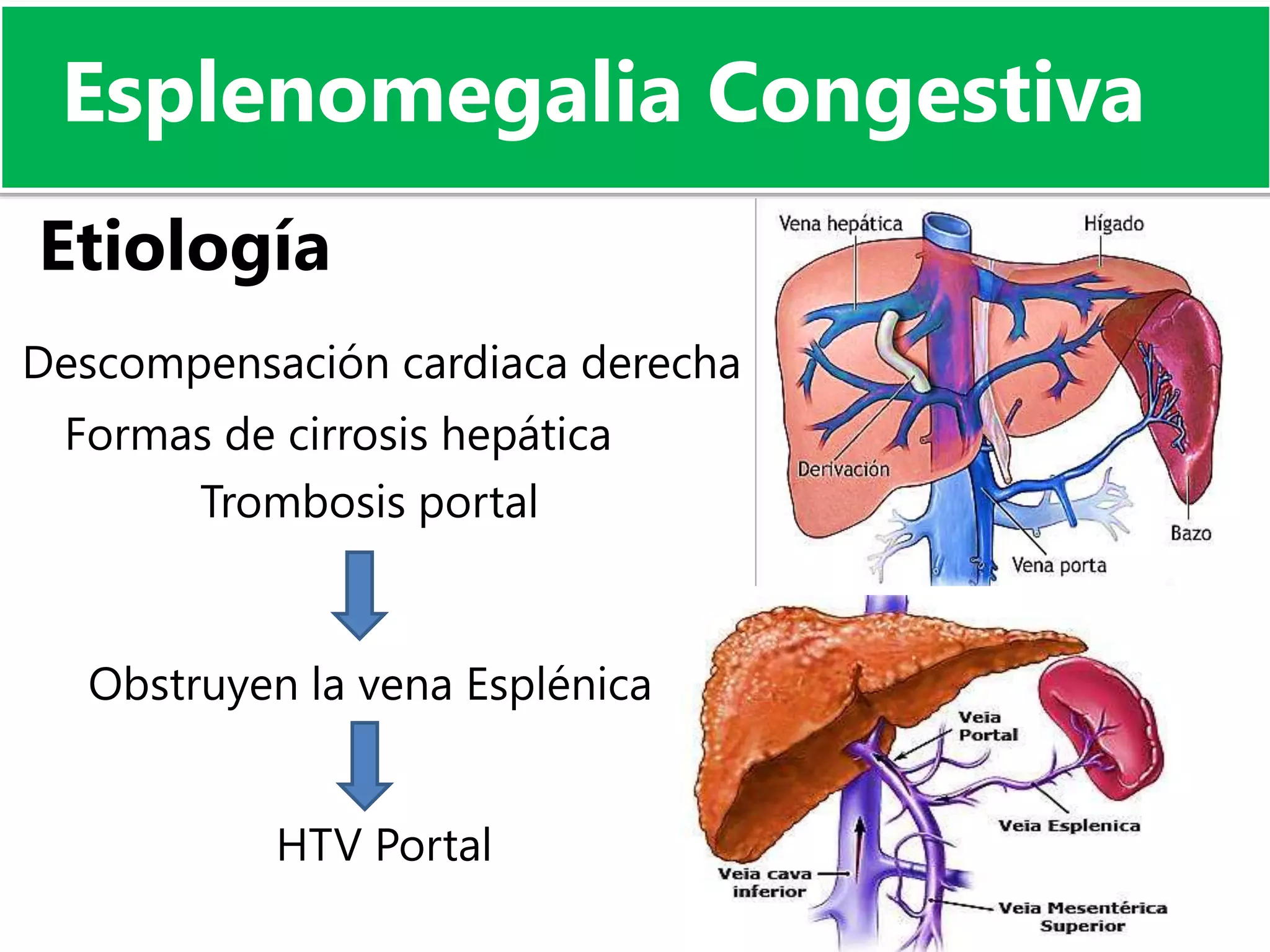 PATOLOGIA Enfermedades de los leucocitos,ganglios linfáticos,bazo y timo | PPT