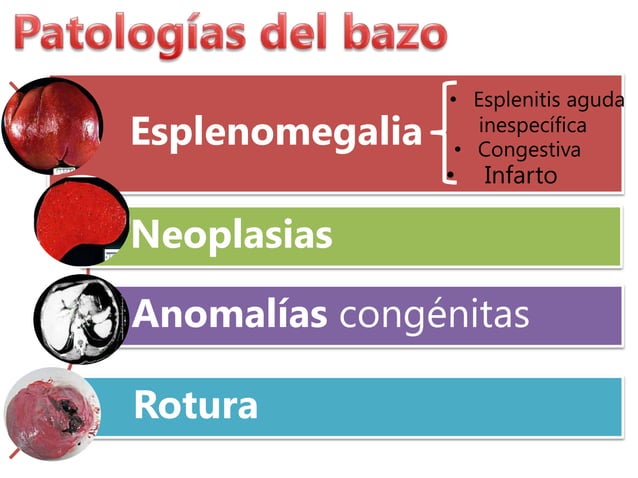 PATOLOGIA Enfermedades de los leucocitos,ganglios linfáticos,bazo y timo | PPT