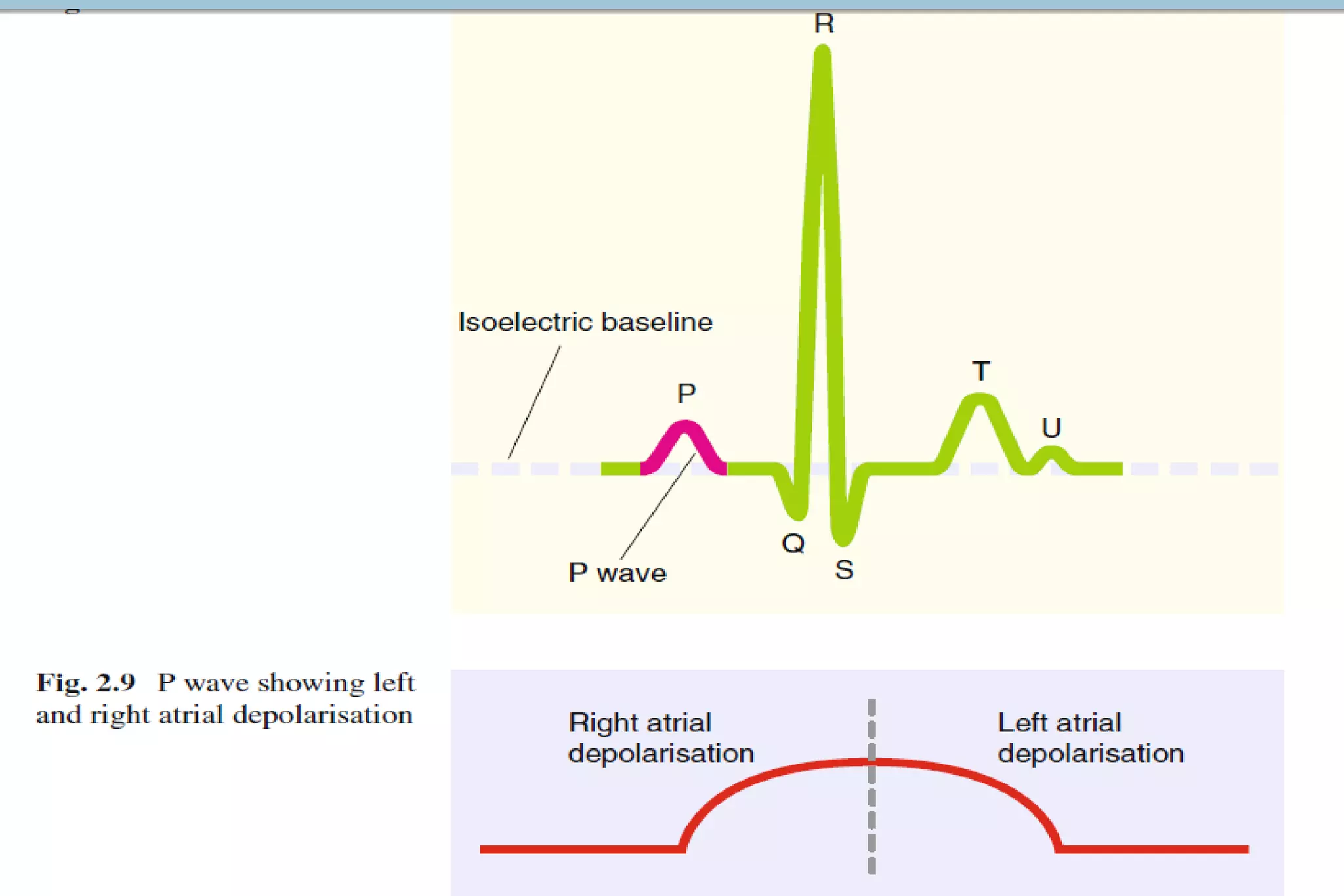 Part ecg stemi nstemi 2019 | PPT | Heart and Cardiovascular Diseases ...