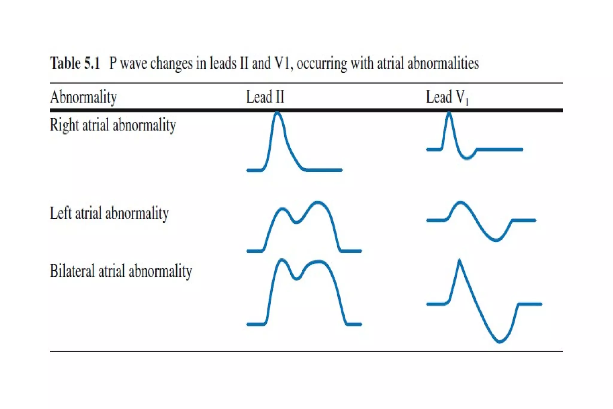 Part ecg stemi nstemi 2019 | PPT | Heart and Cardiovascular Diseases ...