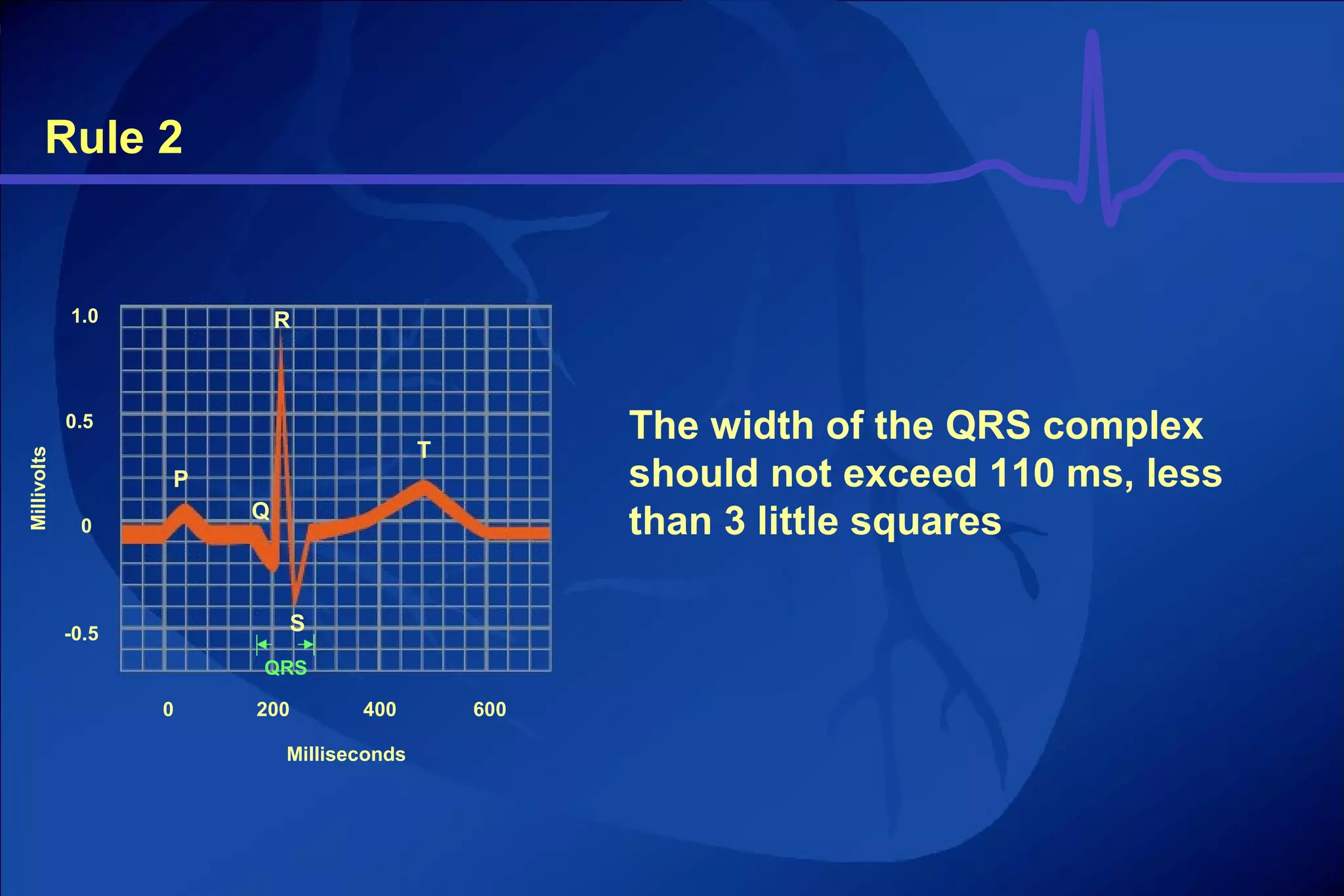 Part ecg stemi nstemi 2019 | PPT | Heart and Cardiovascular Diseases ...
