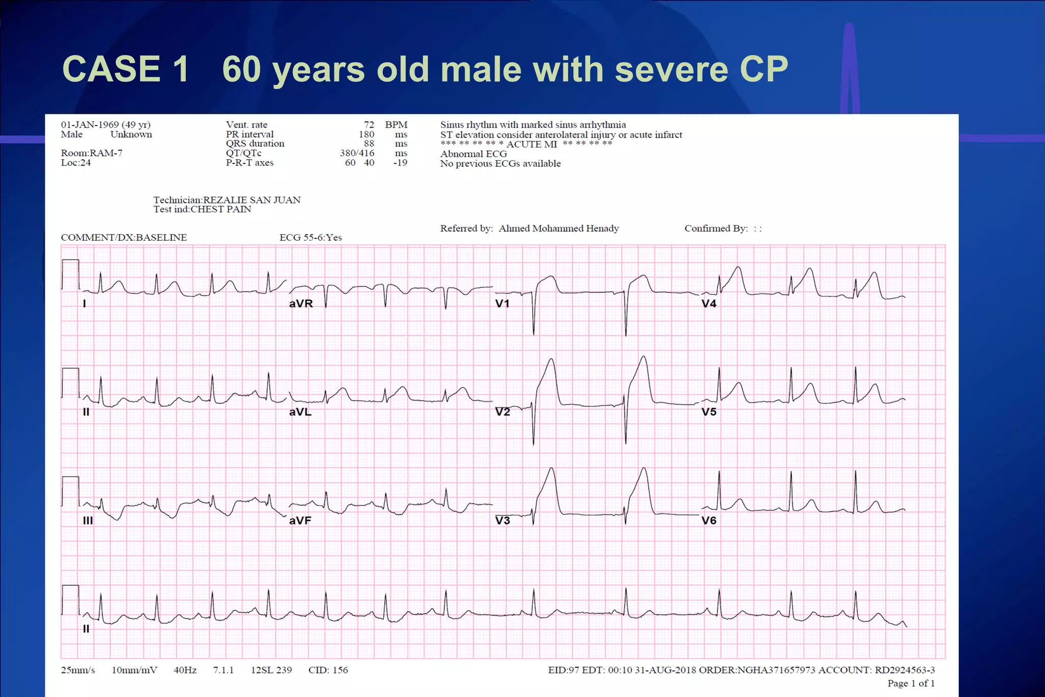 Part ecg stemi nstemi 2019 | PPT | Heart and Cardiovascular Diseases | Diseases and Conditions