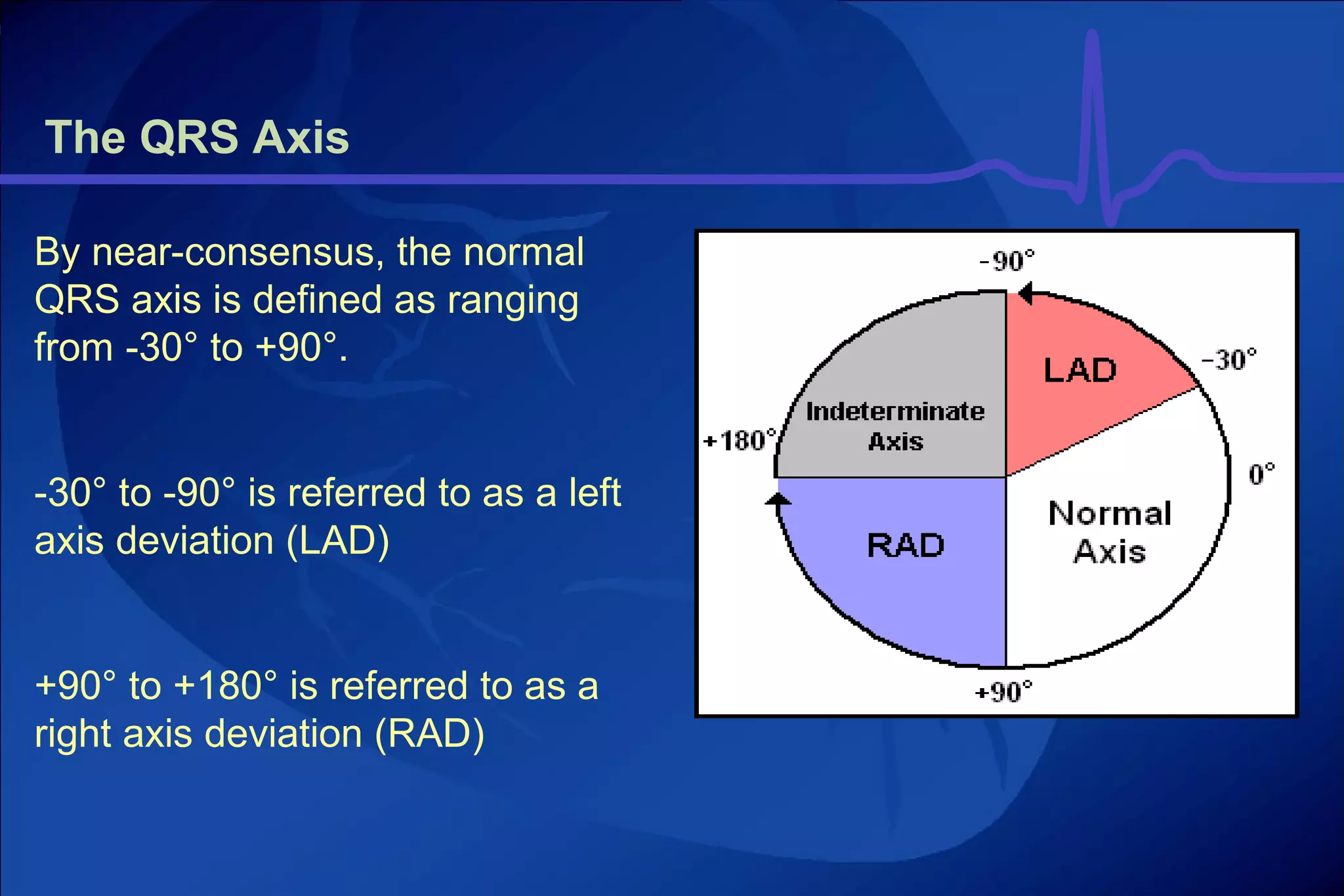 Part ecg stemi nstemi 2019 | PPT | Heart and Cardiovascular Diseases ...