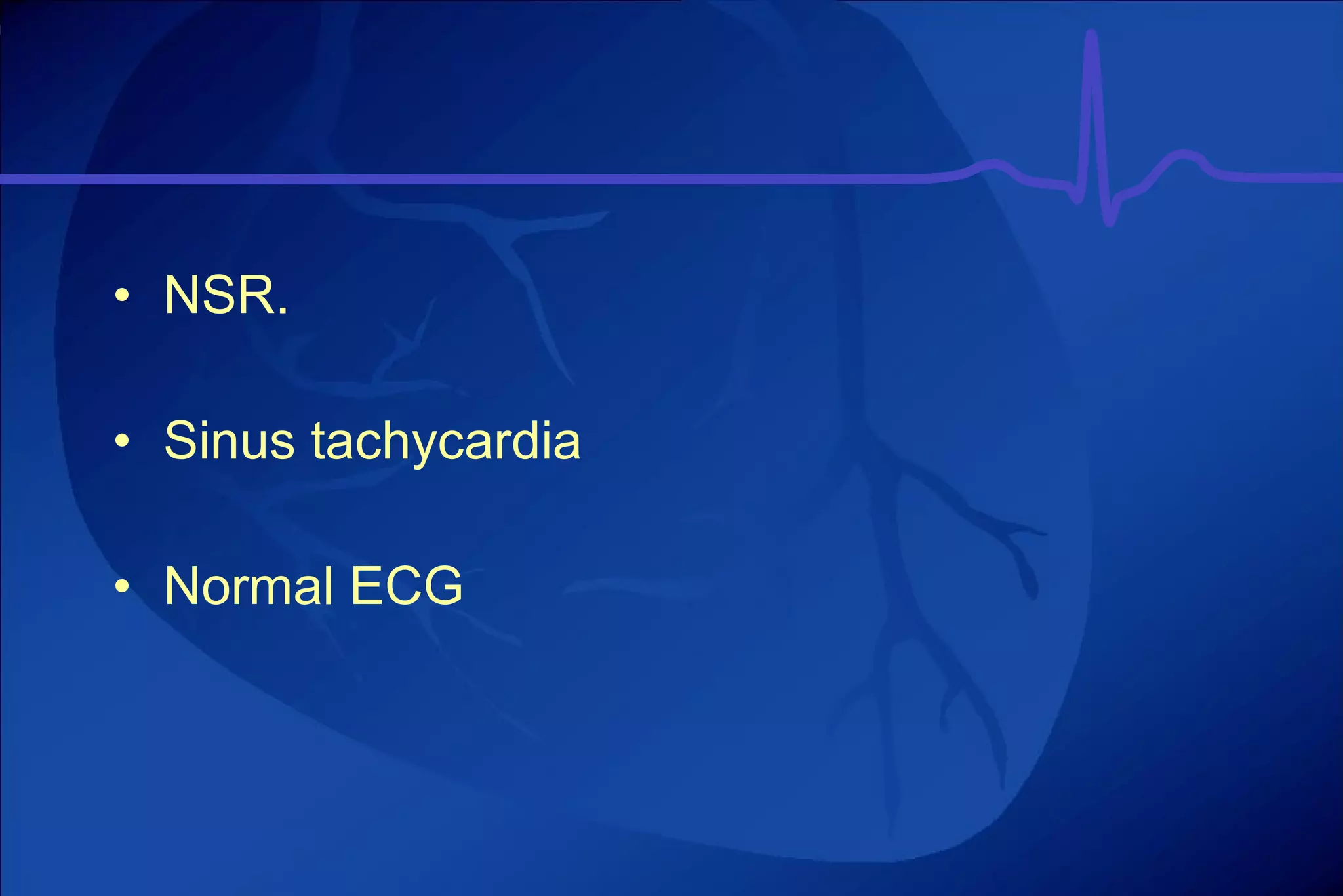 Part ecg stemi nstemi 2019 | PPT | Heart and Cardiovascular Diseases ...