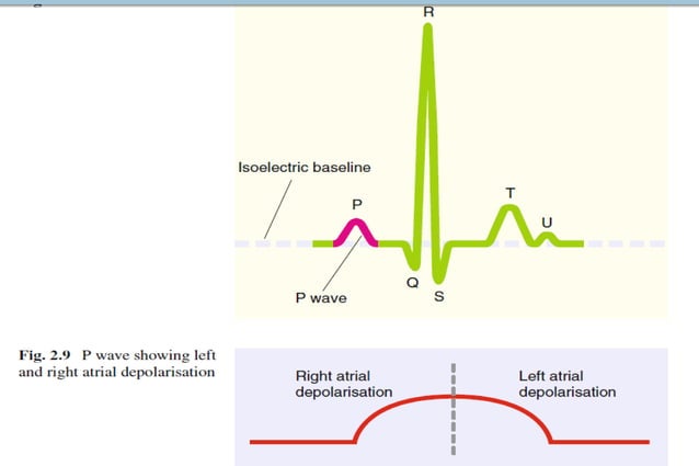 Part ecg stemi nstemi 2019 | PPT | Heart and Cardiovascular Diseases ...