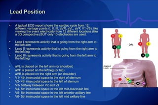 Part ecg stemi nstemi 2019 | PPT | Heart and Cardiovascular Diseases ...