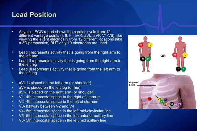 Part ecg stemi nstemi 2019 | PPT | Heart and Cardiovascular Diseases ...