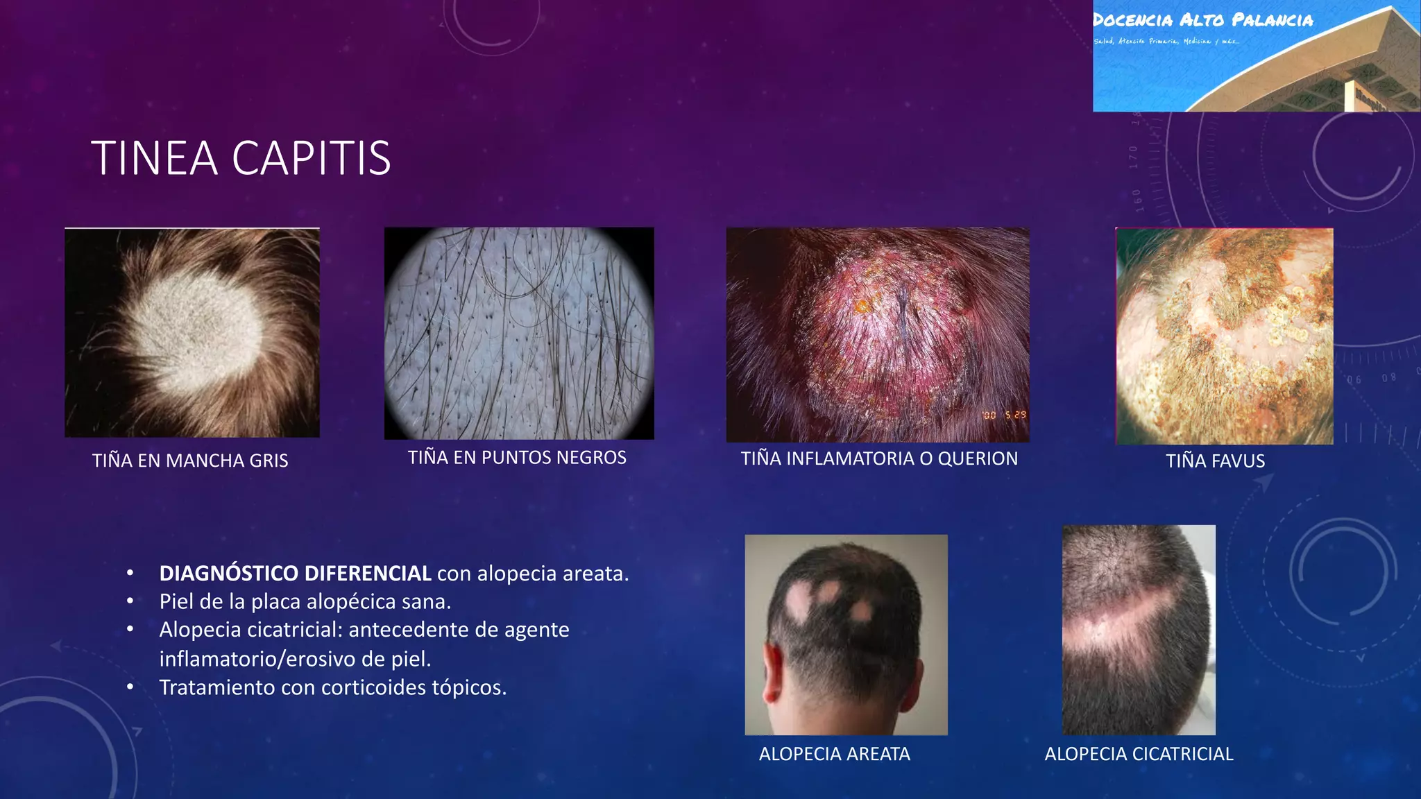 Infecciones cutaneas. I/III | PDF