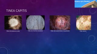 Infecciones cutaneas. I/III | PDF