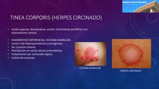 Infecciones cutaneas. I/III | PDF