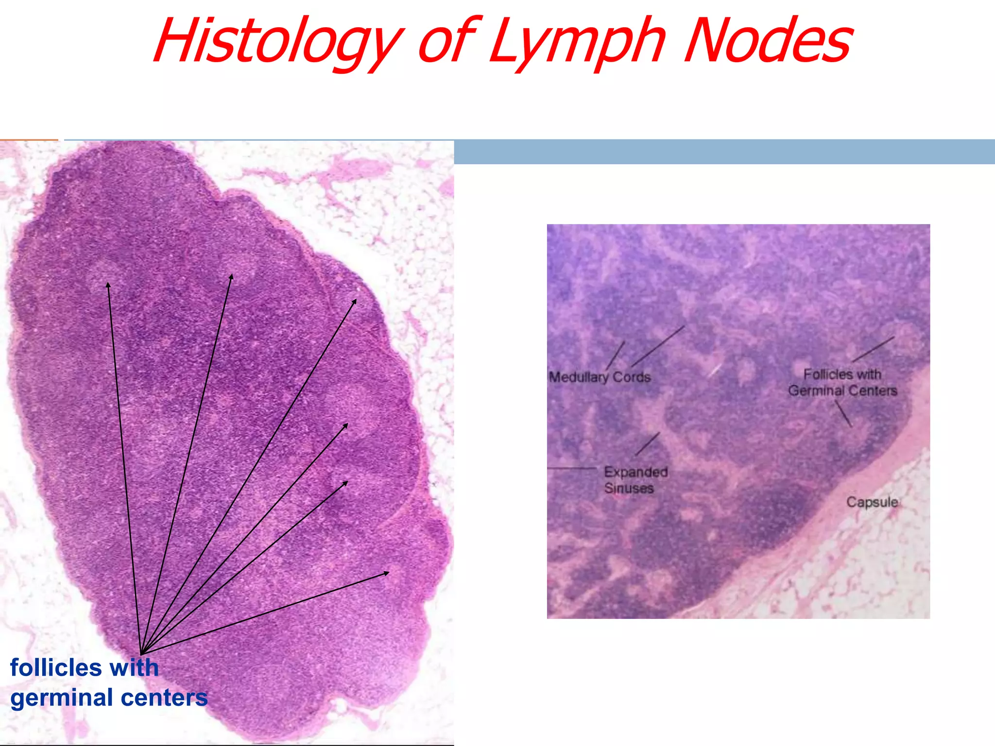 Pattern of inflammatory diseases in lymph node biopsy | PPT