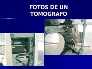 Partes, Funicionamiento y Generaciones de un Tomografo | PDF