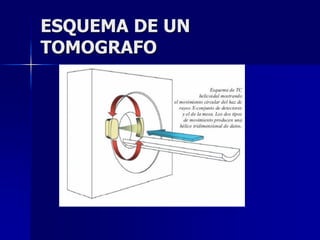 Partes, Funicionamiento y Generaciones de un Tomografo | PDF