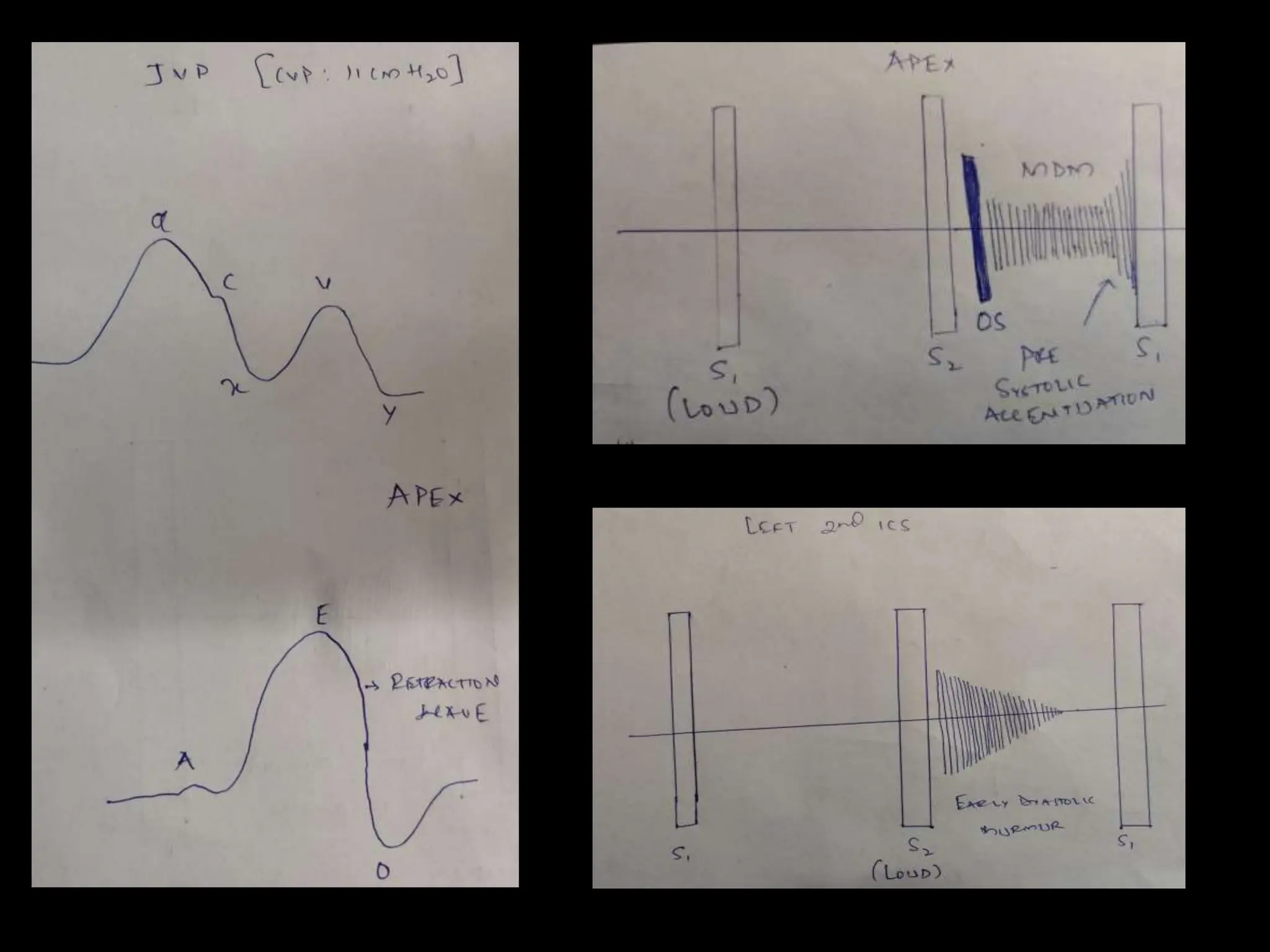 Cardiac Case Presentation DM degree.pptx | Heart and Cardiovascular ...