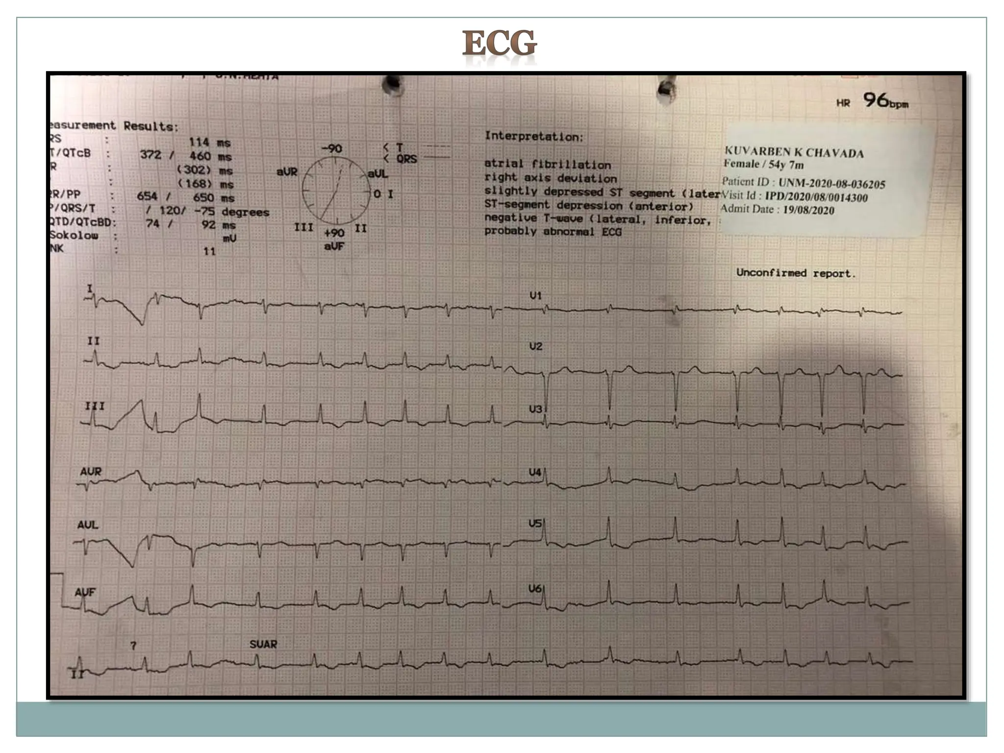 Cardiac Case Presentation DM degree.pptx | Heart and Cardiovascular ...