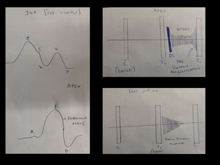 Cardiac Case Presentation DM degree.pptx | Heart and Cardiovascular ...
