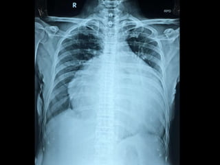 Cardiac Case Presentation DM degree.pptx | Heart and Cardiovascular ...