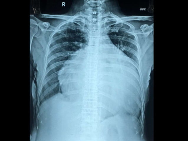 Cardiac Case Presentation DM degree.pptx | Heart and Cardiovascular ...