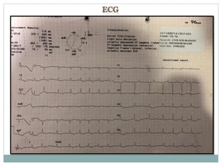Cardiac Case Presentation DM degree.pptx | Heart and Cardiovascular ...