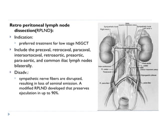 Part 1 management of testicular carcinoma - dr vandana | PPT