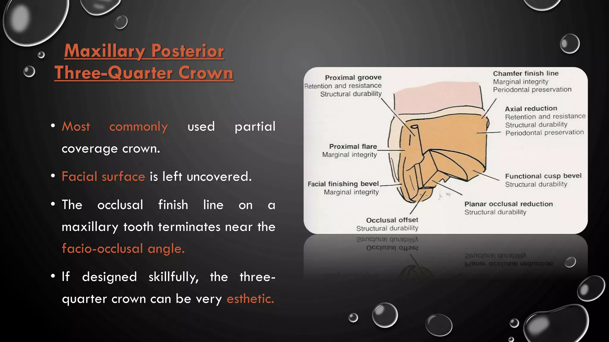 Partial Coverage Restorations.pdf