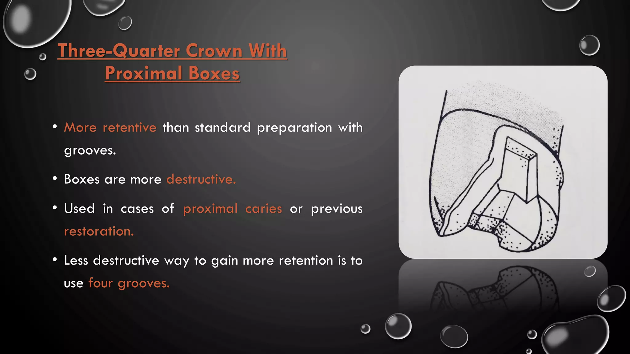 Partial Coverage Restorations.pdf