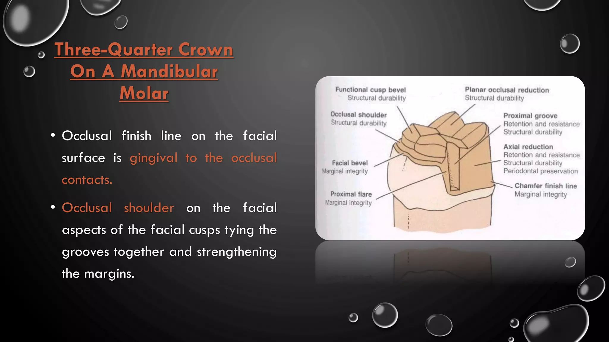 Partial Coverage Restorations.pdf