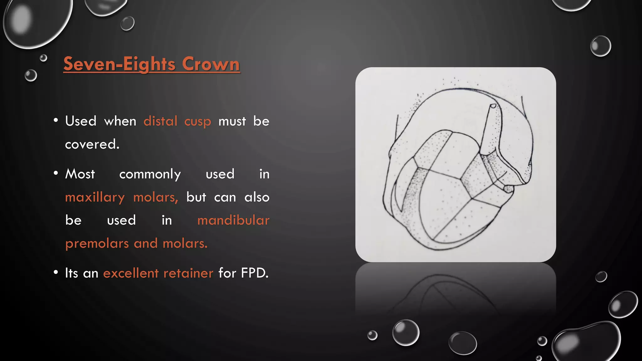 Partial Coverage Restorations.pdf
