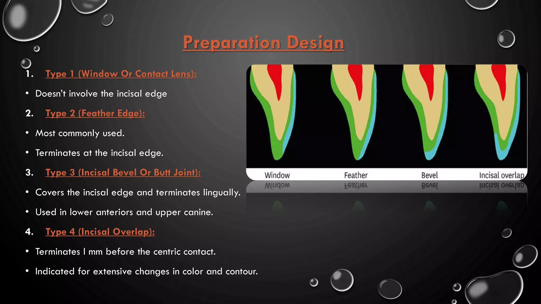 Partial Coverage Restorations.pdf