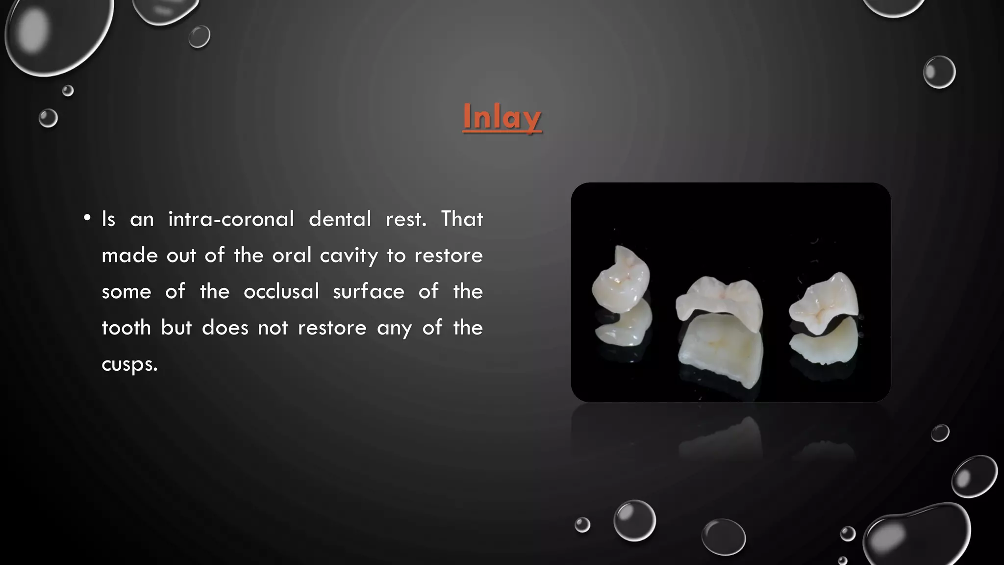 Partial Coverage Restorations.pdf