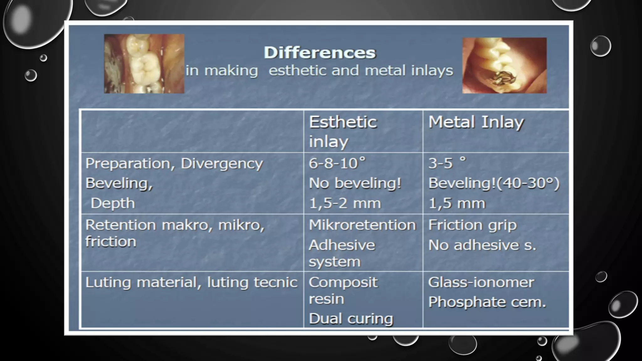 Partial Coverage Restorations.pdf