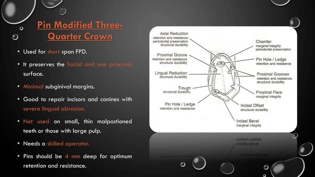 Partial Coverage Restorations.pdf
