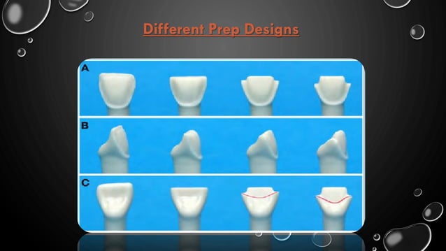 Partial Coverage Restorations.pdf