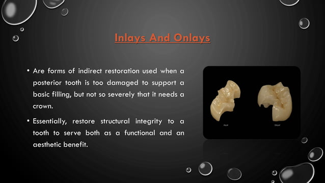 Partial Coverage Restorations.pdf